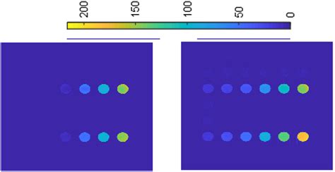 The Results Of Material Decomposition Using The Two Methods For The Download Scientific Diagram