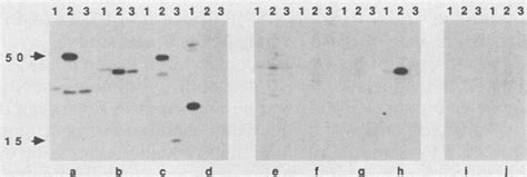 Analysis Of Human Sera For Reactivity With The Sivmac X Proteins
