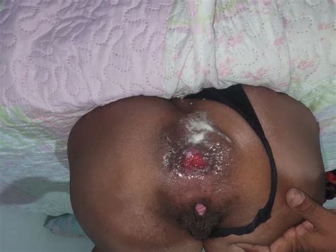 Free Open Anal Porn Videos Xhamster