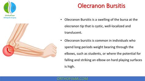 Olecranon Bursa Anatomy