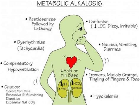 Hypochloremic Alkalosis Causes Signs Symptoms Diagnosis Treatment And Prognosis