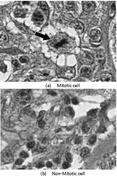 Figure 1 From Mitosis Detection In Breast Cancer Histological Images Based On Texture Features