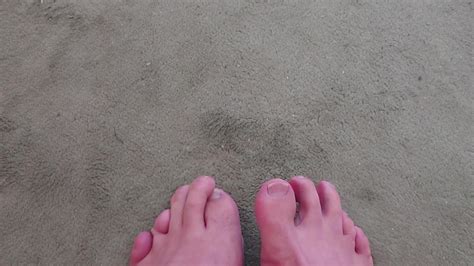 Please Comment My Deformed Toes