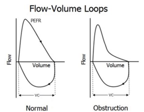 Pulmonary Function Testing Flashcards Quizlet