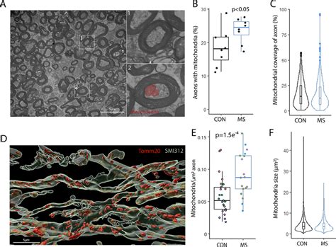 Increased Number Of Axonal Mitochondria In Multiple Sclerosis Ms Download Scientific Diagram
