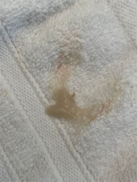 My Chronic Sinusitis Success Story Thick Mucus Brain Fog Fatigue Rsinusitis