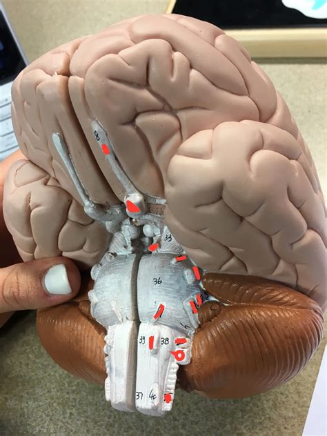 Vestibulocochlear Nerve Model