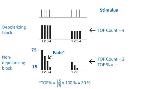 Nmt Helping To Optimize Recovery From Anesthesia Clinical View