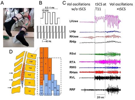 Day 326 Review The State Of Spinal Cord Research Lunatic Laboratories