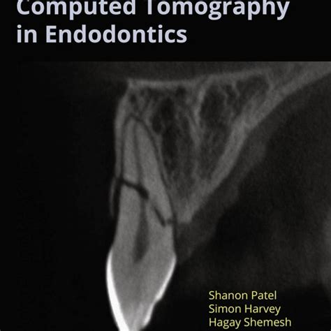 Stream Read Cone Beam Computed Tomography In Endodontics From Gbahanyertara Listen Online For