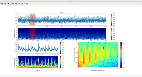 Github Musaelabamplitude Modulation Analysis Module Amplitude