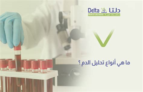 أنواع تحليل الدم الشاملة وكيف نقرأ رموز تحاليل الدم
