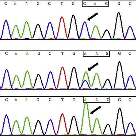 Partial Nucleotide Sequences Of NDP Exon 3 An Affected Male Shows A Download Scientific