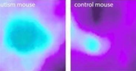 Insular Cortex Alterations In Mouse Models Of Autism Max Planck Gesellschaft