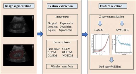 Two Dimensional Ultrasound Based Radiomics Nomogram For T2dm Ijgm