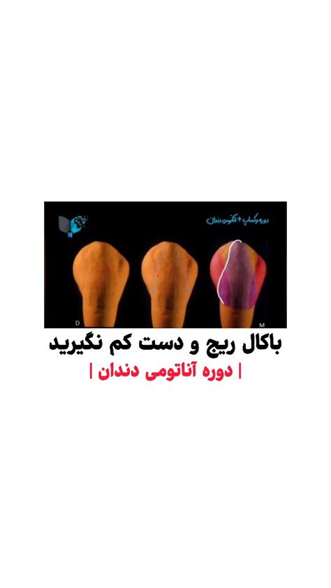 آموزش آناتومی دندان وکساپ ‎ ‎ ️ ️با لایک هاتون بهمون انگیزه بدید ️