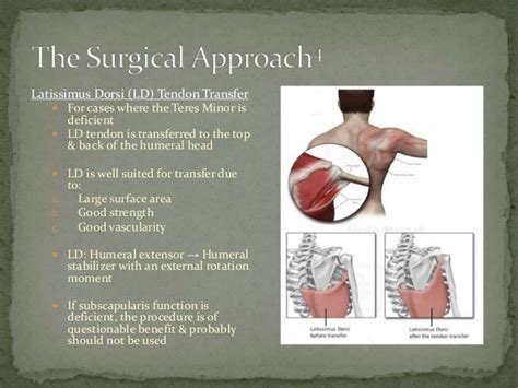 Reverse Total Shoulder Replacement Final