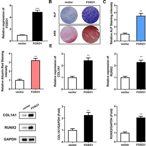 Clinical Expression Of Foxo1 And Expression In Pdlscs During Osteogenic
