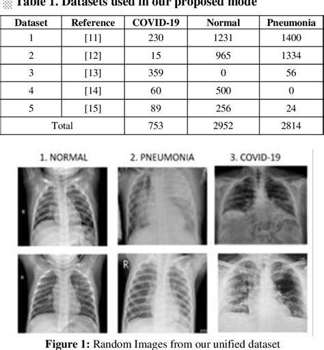 Figure 1 From Ensemble Deep Convolution Neural Network For Sars Cov V2 Detection Semantic Scholar