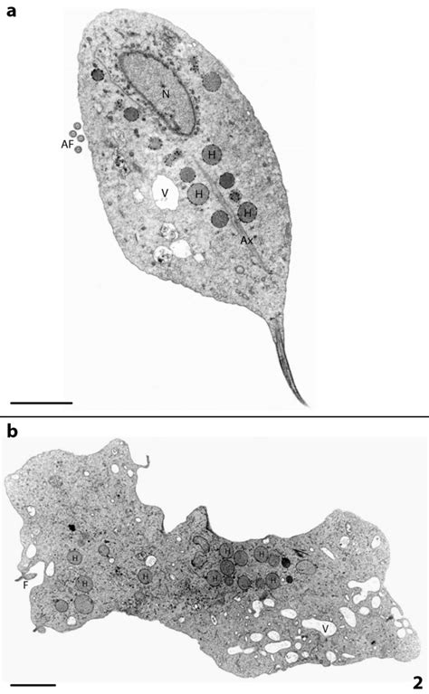 General View Of Trichomonas Vaginalis As Seen By Transmission Electron Download Scientific
