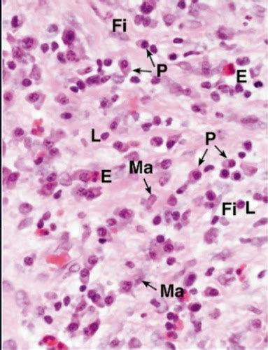 Case 10 Part 2 Flashcards Quizlet