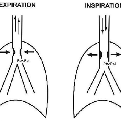 Spirometry With Flow Volume Loop Showing Box Pattern Suggestive Of Download Scientific