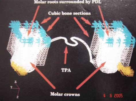 Finite Element Analysis In Orthodontics Ppt