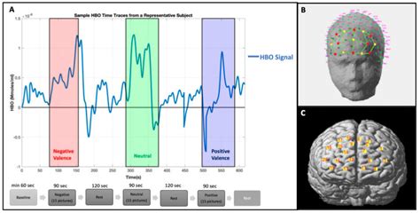 A Experimental Protocol And Stimulus Timing A Sample Time Trace Of
