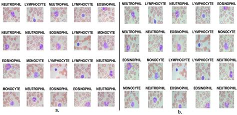 1a Hematology Slides