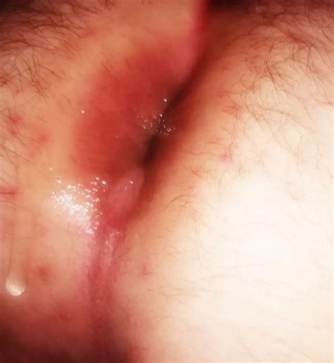 Im In Bondage Can You Please Fuck Me 💯🤤 11 Nude Pics Xhamster