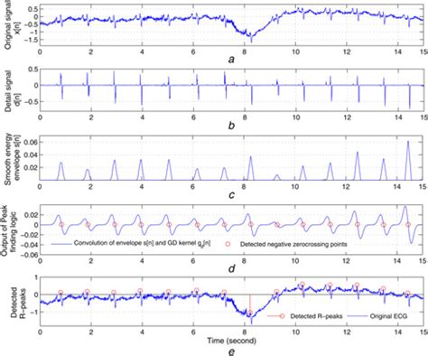 Straightforward And Robust Qrs Detection Algorithm For Wearable Cardiac