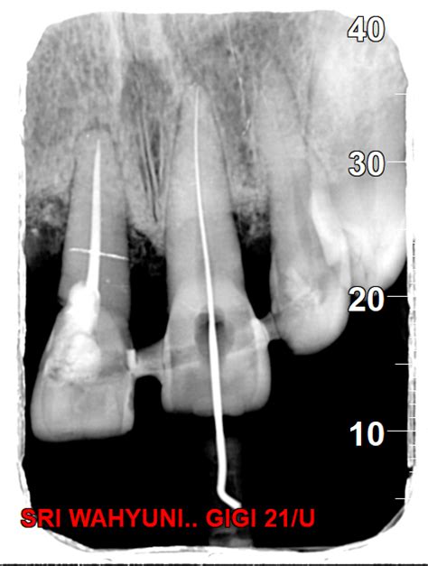 Yolo V8 Kim Object Detection Model By Kimiaus Saadah