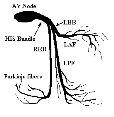 Left Anterior Fascicular Block Lafb