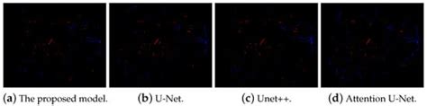 A Multi Scale Attention Fusion Network For Retinal Vessel Segmentation