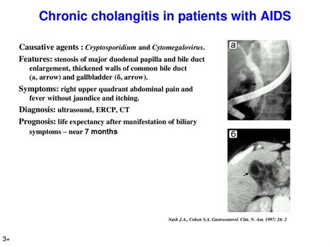 Obstructive Jaundice And Cholangitis презентация онлайн