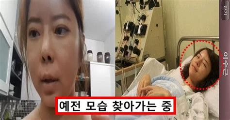얼굴이 무너졌다 이수근 아내 박지연 스테로이드 부작용 근황 공개에 모두 응원했다
