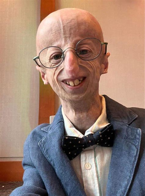 Muere Sammy Basso El Científico Italiano Que Visibilizó La Progeria A