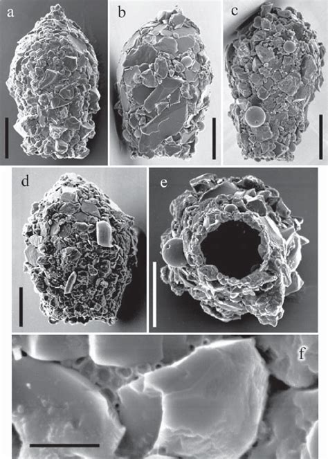 Different Specimens Of Difflugia Amphoralis From C Ogdens Sem Download Scientific Diagram