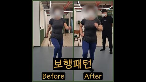 💡보행패턴 Before And After💡김포 체형교정트레이닝센터 코어스파인 Youtube