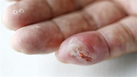 Itching Whats Causing Your Itchy Skin With Pictures