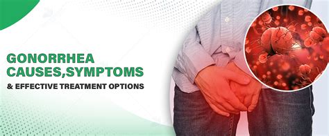 Gonorrhea Causes Symptoms And Effective Treatment Options