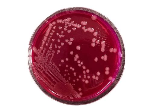 21 Cultural Characteristics Salmonella Royalty Free Images Stock