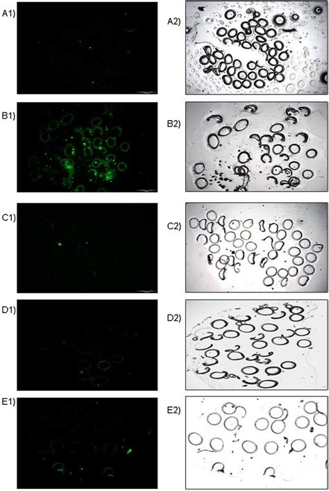 Cardiac Troponin I But Not Cardiac Troponin T Adheres To Polysulfone Dialyser Membranes In An In
