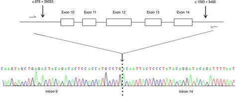 Dna Sequence Electropherogram Showing The Boundaries Of The Large