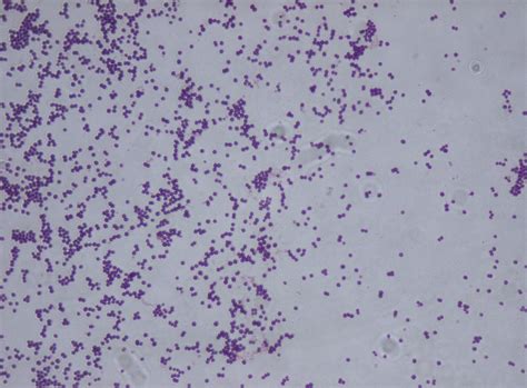 Staphylococcus Saprophyticus Wikipedia