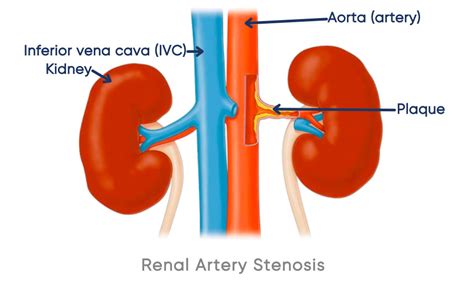 renal vasculature renal artery anatomy branches supply kenhub