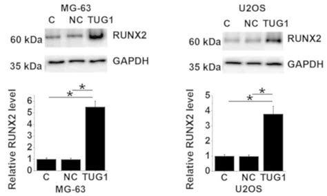 Lncrna Tug1 Promotes The Development Of Osteosarcoma Through Runx2