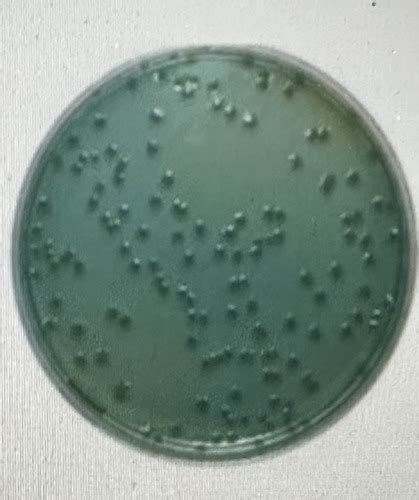 Microbes Lab Quiz 4 Flashcards Quizlet