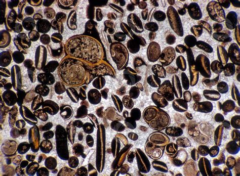 Bioclastic Limestone Fossil Thin Section In Plane Polarized Light 32x Bioclastic Limestone