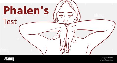 Stock Illustration Of Phalens Test Stock Vector Image And Art Alamy